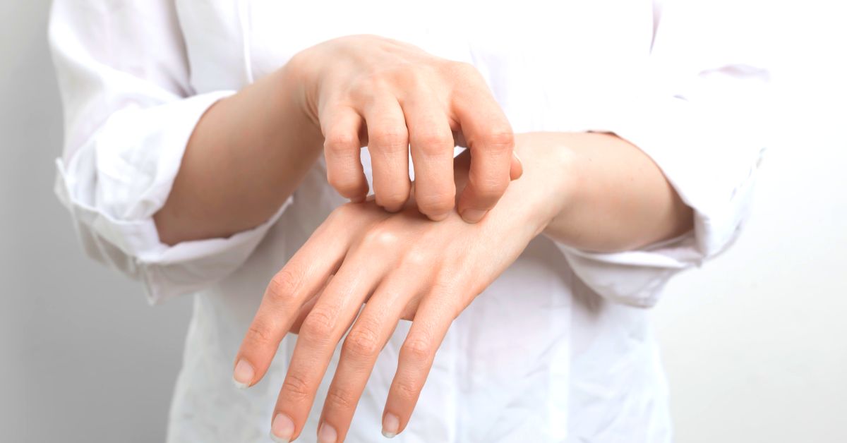 Scabies Treatment in Neath – Free NHS Advice & Skin Care - The Health ...